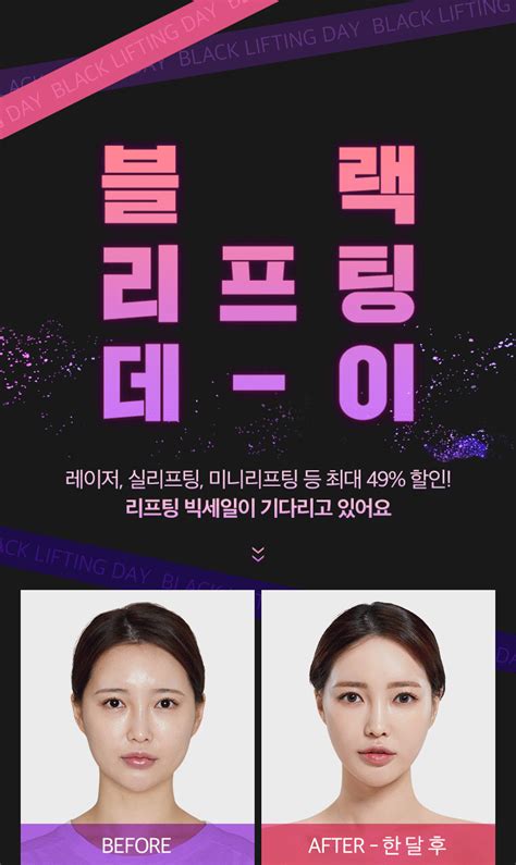 리프팅하면 리팅성형외과