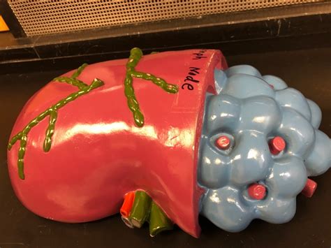 Solved Label Lymph Node