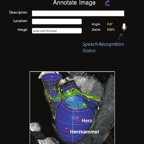 AI And HCI Technology Limitations And Challenges Download Scientific Diagram
