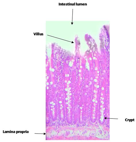 Morphometric Analysis Of Duodenum Villus Height And Crypt Depth 5 µm