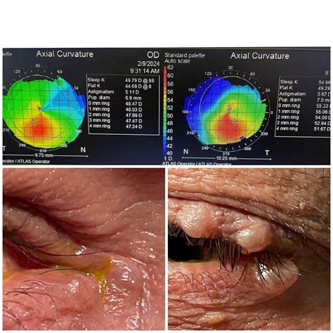 Sean Mccafferty On Linkedin Fridays Patient How Are These Findings Related