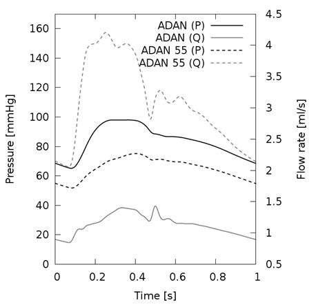 Waveform Comparisons Between Adan Model Solid Line And Adan 55 Model