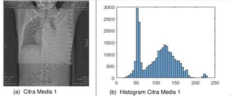 Gambar Tersebut Merupakan Histogram Yang Merepresentasikan Distribusi