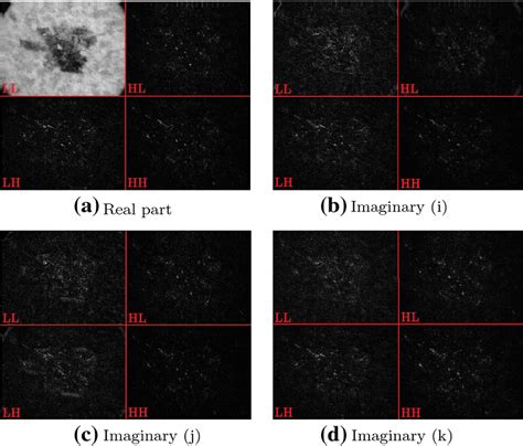 Skin Lesion Image Decomposed By The Qwt To 16 Wavelet Sub Bands