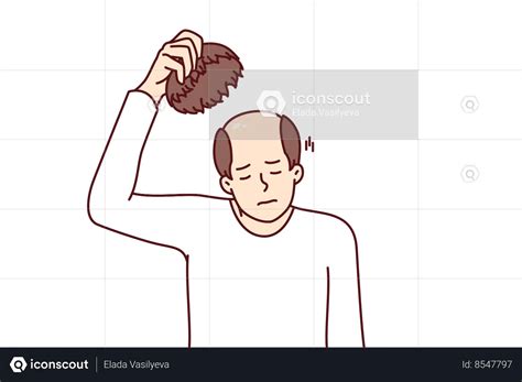 Best Man Takes Off Wig And Experiences Stress Of Baldness Caused By