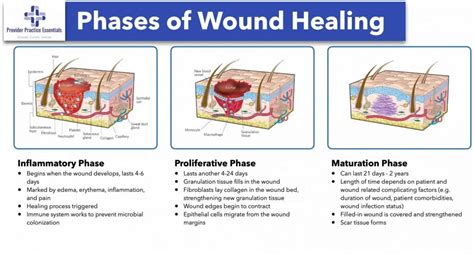 Granulation Tissue Wound Healing