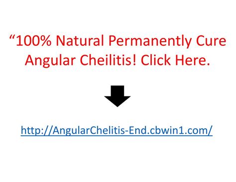 Ppt Corner Of Mouth Cracked Angular Cheilitis Home Remedies For Angular Cheilitis Angular