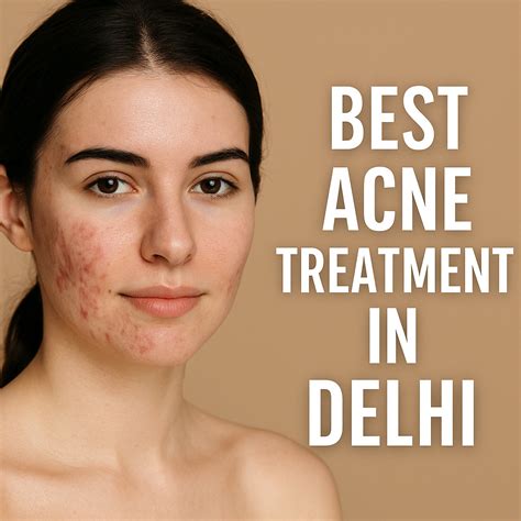 Best Acne Treatment In Delhi Expert Care By Dr Namrata Ghai