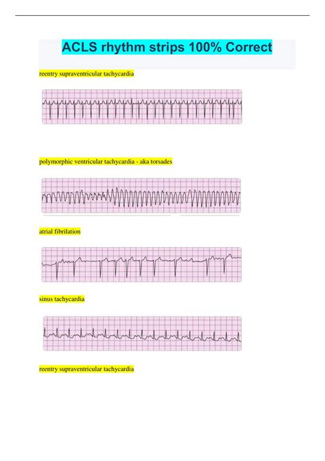 Acls Rhythm Strips 100 Correct Acls Stuvia Uk