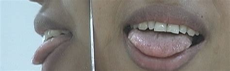 The Phonetic Status Of The Inter Dental Approximant Hughs Curriculum Vitae