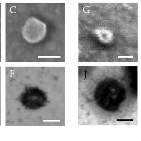 electron microscopy of ev like nanoparticles in native csf a and evs