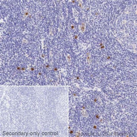 Biotin Anti Cd63 抗体 [epr5702] Late Endosome Marker Ab316180