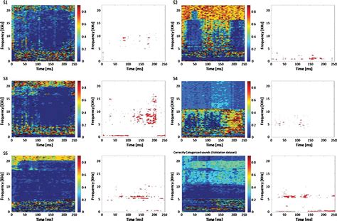 Figure 1 From Auditory Perceptual Decision Making Based On Semantic Categorization Of