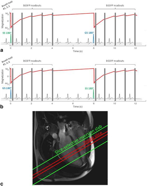 A Schematic Of The Ll Fair Asl Pulse Sequence Over 13 Heartbeats For Download Scientific