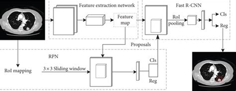 Faster R Cnn Nodule Detection Framework Download Scientific Diagram