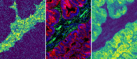 Spatially Resolved Single Cell Metabolic Profiling By Multimodal Msi
