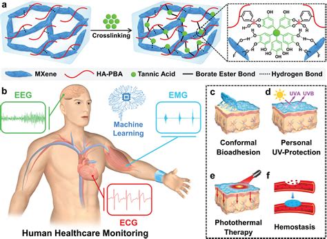Innovative Mxene Hydrogel Enables Wearable Health Monitoring And Treatment