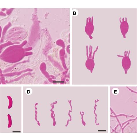 Figure E Microscopic Structures Of E Subsaccharina Dai Iiiii And Ly Download Scientific