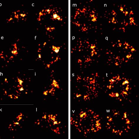 Continuous Heterogeneity Detection Pipeline N Particles Are Registered Download Scientific