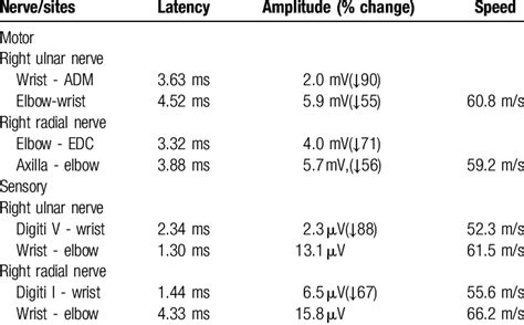 Result Of Ulnar And Radial Nerve Conduction Study Download