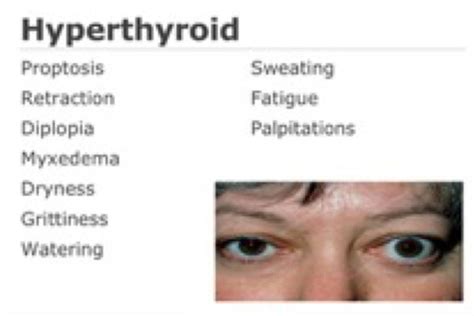 Block 11 Thyroid Flashcards Quizlet Block 11 Thyroid Flashcards Quizlet