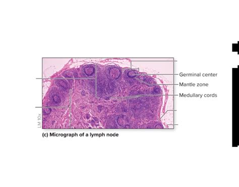 Label Lymph Node Quiz