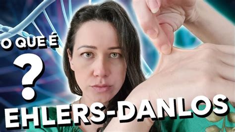 Sintomas Da Síndrome De Ehlers Danlos O Que Você Precisa Saber