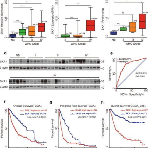 Suppression Of Ska1 Inhibits Glioma Cell Migration And Invasion Ability