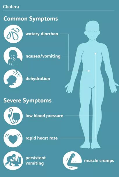 What Is Cholera And Its Symptoms Go Local Classified Articles