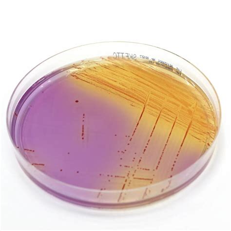 Streptococcal Kf Ttc Agar Ewc Diagnostics