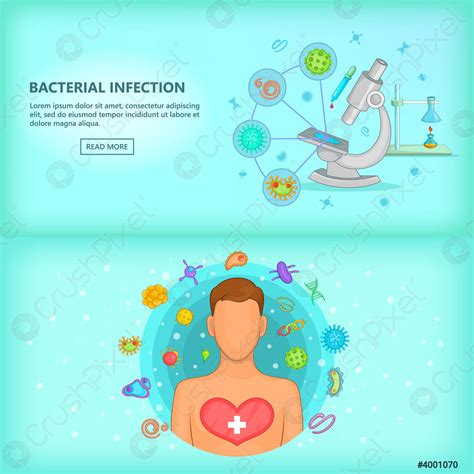 Virus Banner Set Horizontal Cartoon Style Stock Vector 4001070