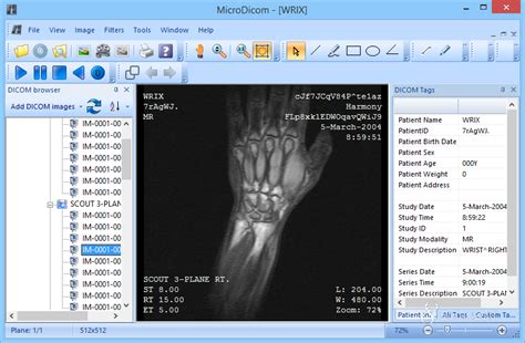 什么是 Microdicom Viewer？（microdicom开发）