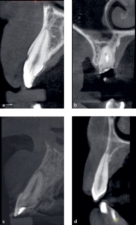 Figure 3 From A Clinical Classification System For The Treatment Of