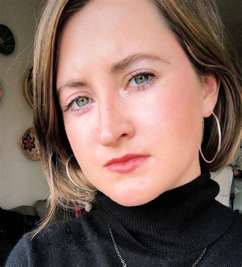 How Long Does It Take Doxycycline To Work For Acne The Daley Dose