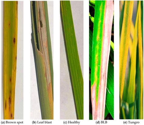Classification And Detection Of Rice Diseases Using A 3 Stage Cnn Architecture With Transfer