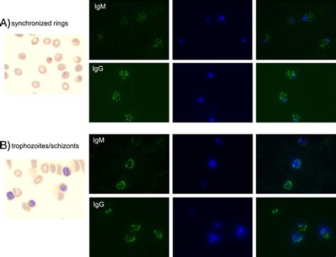 Representative Ifa Staining Pattern Of P Falciparum Antibodies