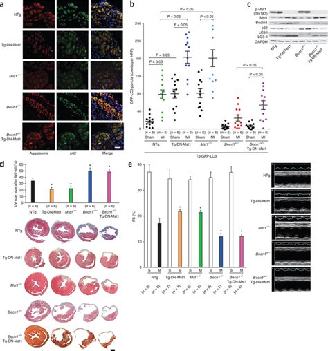 Suppression Of Autophagy During The Chronic Phase Of Myocardial Download Scientific Diagram