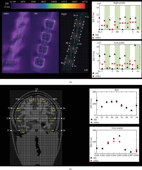 Figure 1 From Mri Based Multiscale Model For Electromagnetic Analysis In The Human Head With