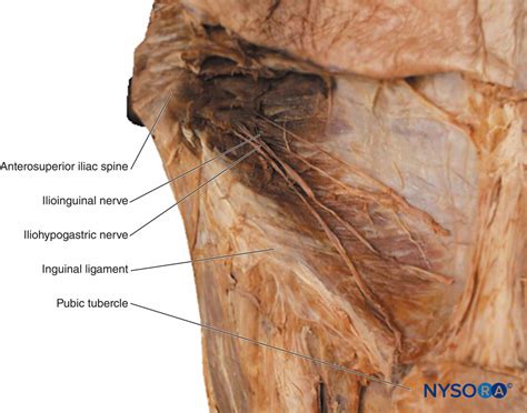 Ilioinguinal Nerve Anatomy