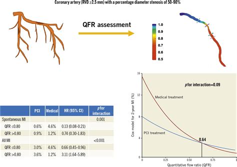 Quantitative Flow Ratio As A Continuous Predictor Of Myocardial Infarction Eurointervention