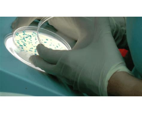 How To Prevent Leukoplakia From Advancing Into Cancer