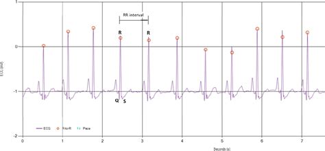 Figure 1 From Heart Rate Measurement Using The Built In Triaxial