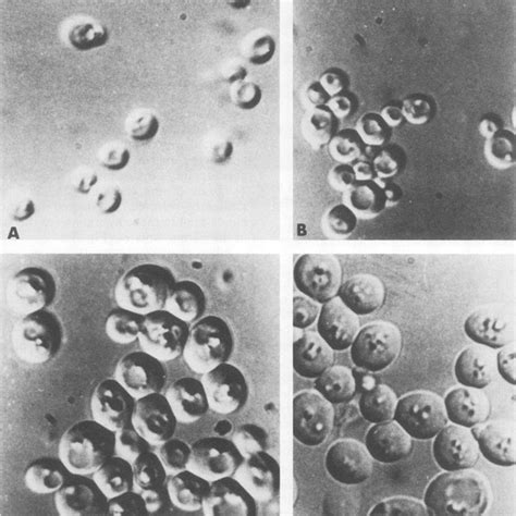 Stationary Phase Cells Grown In Yeast Extract Glucose Peptone Broth