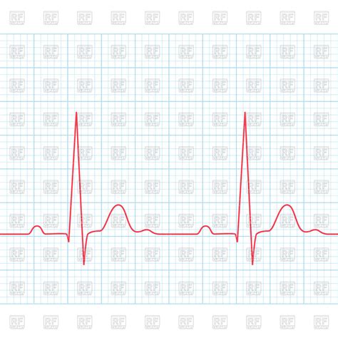Ecg Vectors At Getdrawings Free Download