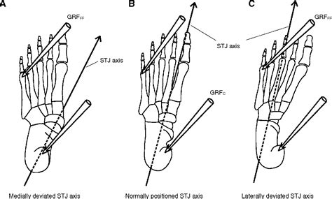 Download Ball And Socket Joint Movement Around Longitudinal Axis