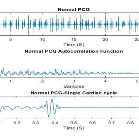 Normal Pcg Acf One Cardiac Cycle Download Scientific Diagram