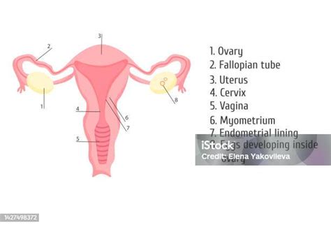 여성 생식기 인포그래픽 벡터 일러스트 레이 션 Polycystic Ovary Syndrome에 대한 스톡 벡터 아트 및 기타 이미지 Polycystic Ovary