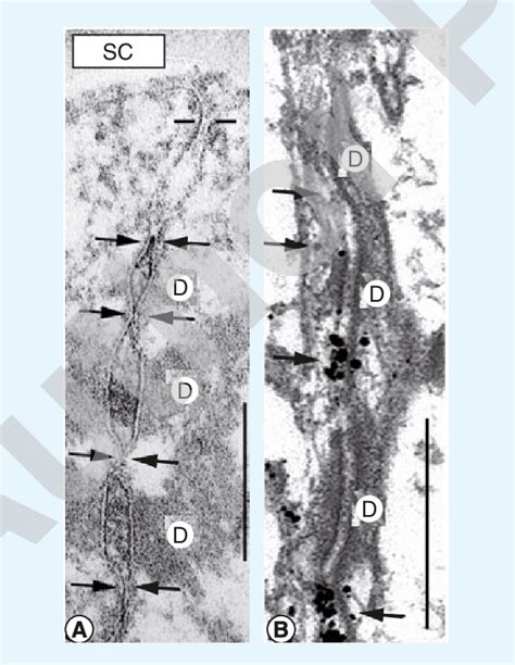 Electron Micrographs Of Ultrathin Sections Through The Uppermost Cell