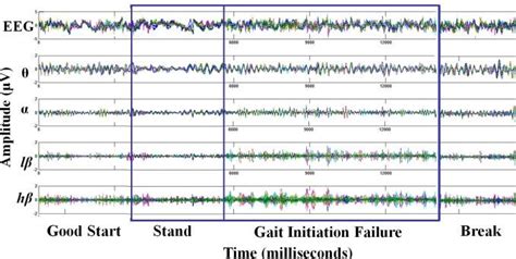 The Comparison Of Amplitude And Frequency Of Raw Eeg Data Between Gs