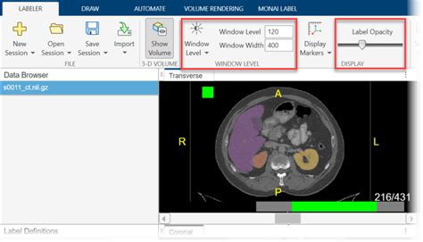 Segment Ct Scan Using Monai Label Matlab And Simulink